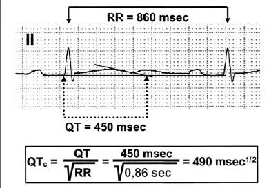 Die QTc Zeit immer mal wieder… – Psychiatrie to go